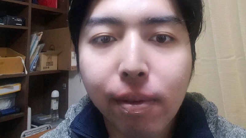 【雑談】統合失調症+鬱 薬1日22錠以上飲む男 - 2023/3/24(金) 15:29開始 - ニコニコ生放送